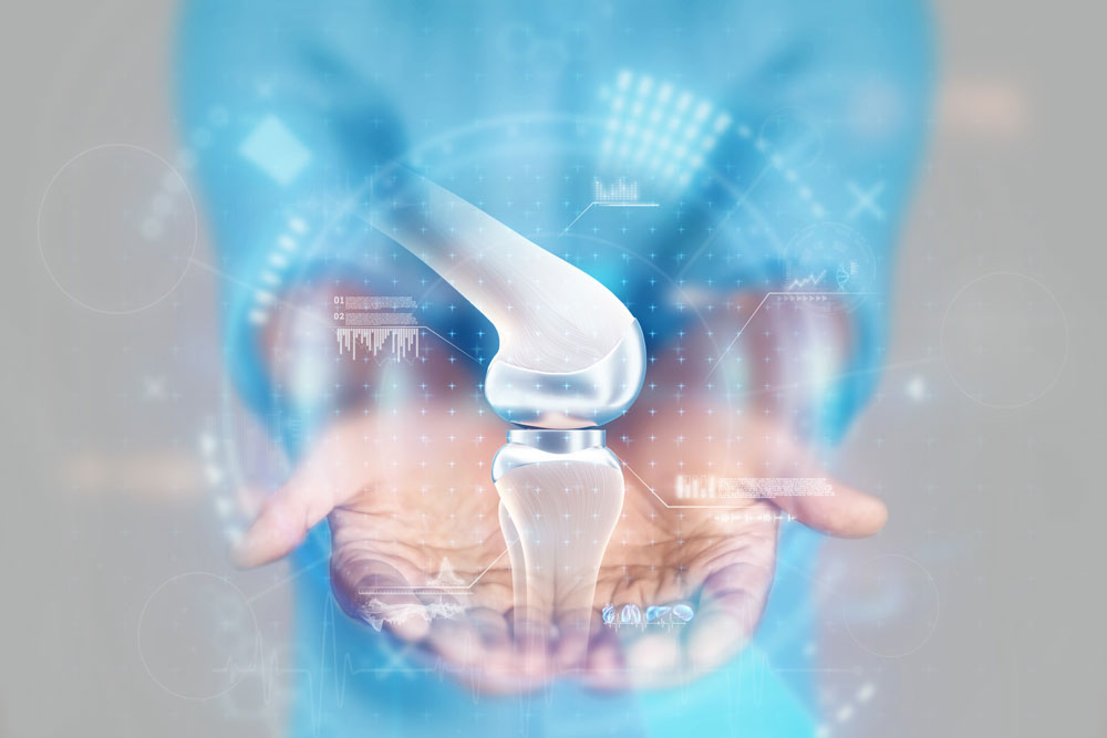 Limitaciones con prótesis de rodilla | Doctor Villanueva