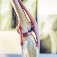 Las prótesis de rodilla | ¡Todo lo que debes saber!
